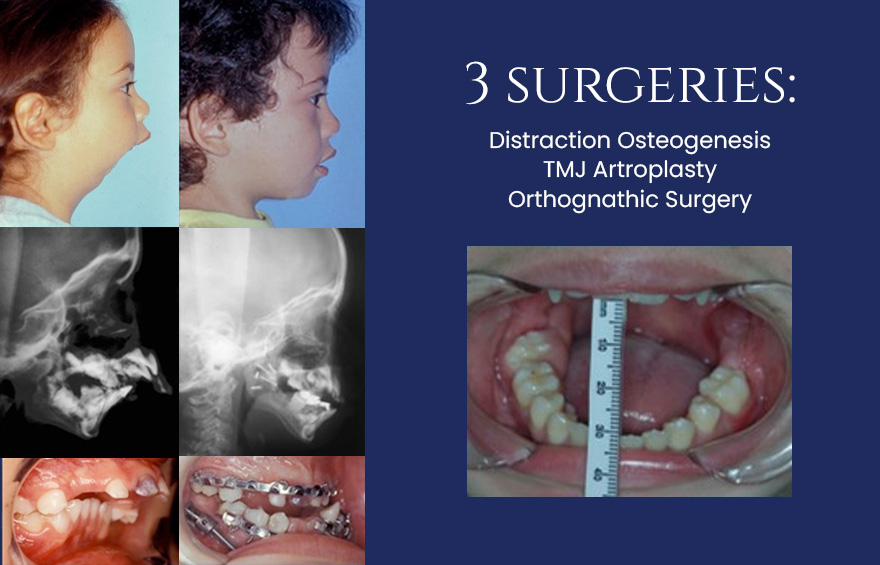Oral and Maxillofacial Surgeon | Dr. Cesar Guerrero